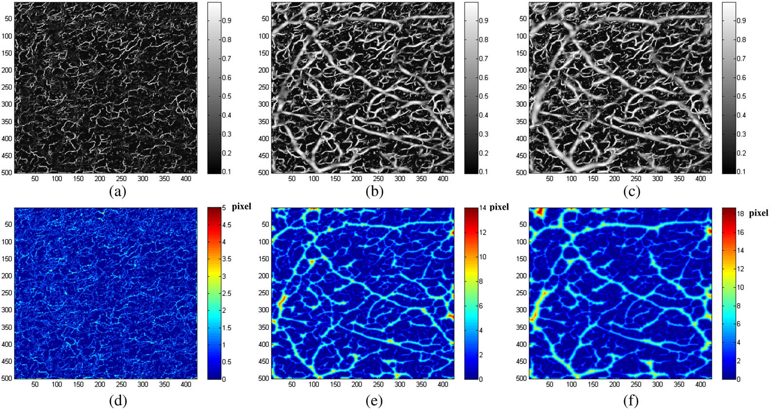 Multiscale Hessian filter-based segmentation and quantification method ...